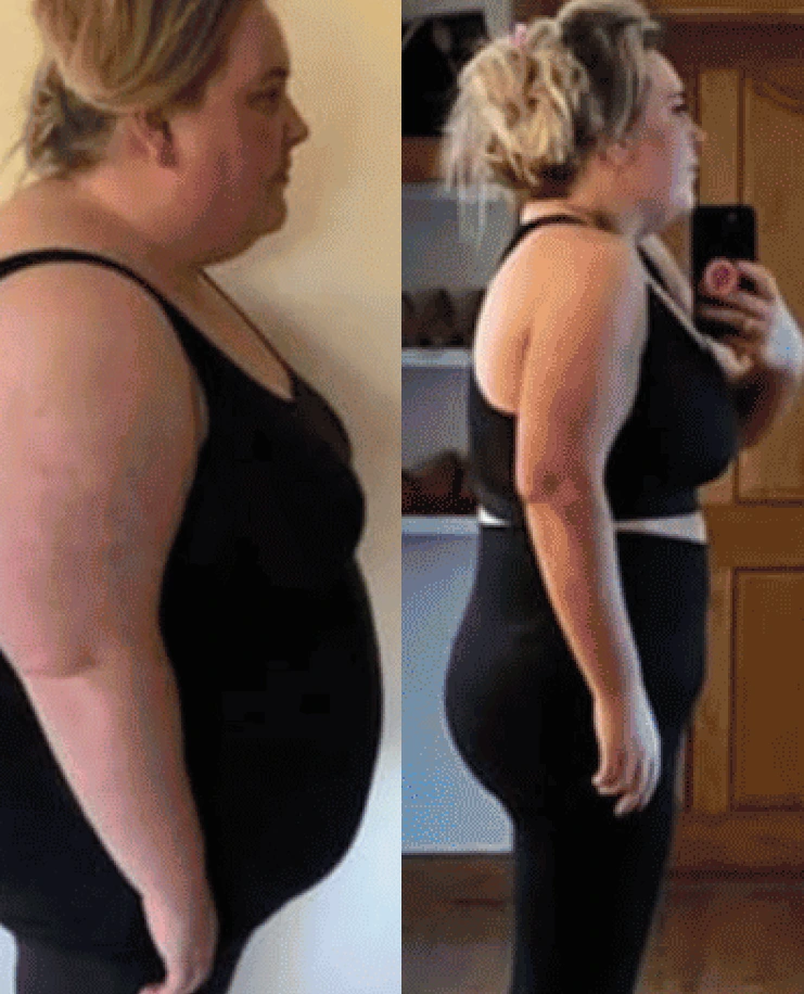 The 5 Best Weight Loss Patches